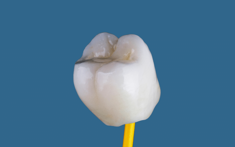 Repairing Or Replacing A Broken Crown