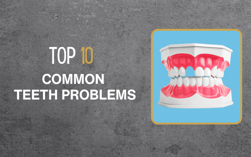 Top 10 Common Teeth Problems You Should Know